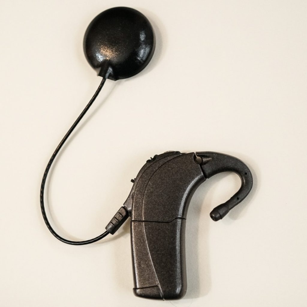 University of Iowa otolaryngologists were the first in the U.S. to ...