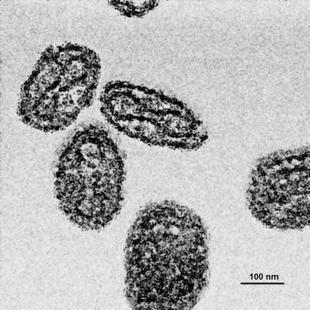 Variolation was introduced to Great Britain - LifeScienceHistory.com