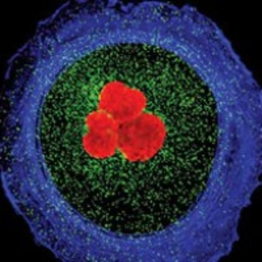 The Eli and Edythe Broad CIRM Center for Regenerative Medicine and Stem ...