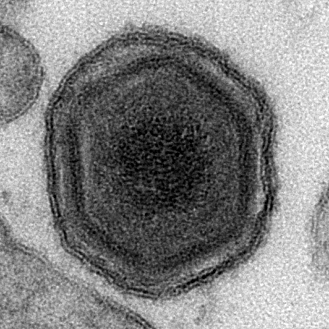 Small World - LifeScienceHistory.com