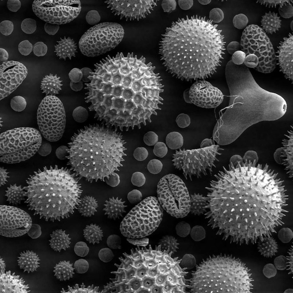 The word "allergen" first used in reference to allergic antibodies ...