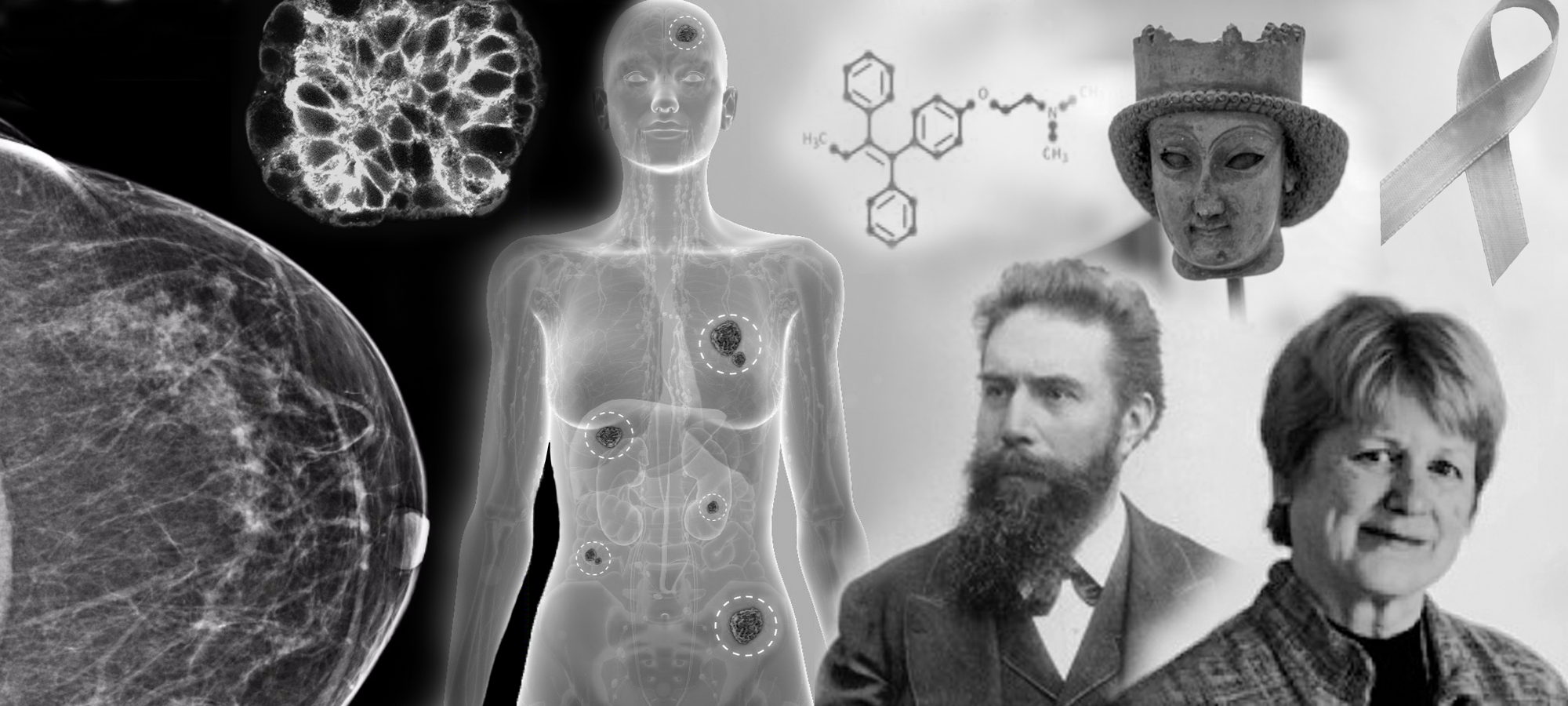 Breast Cancer Pioneers - LifeScienceHistory.com