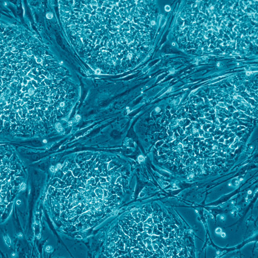 map of genomic and proteomic pathways created by Project Grandiose ...